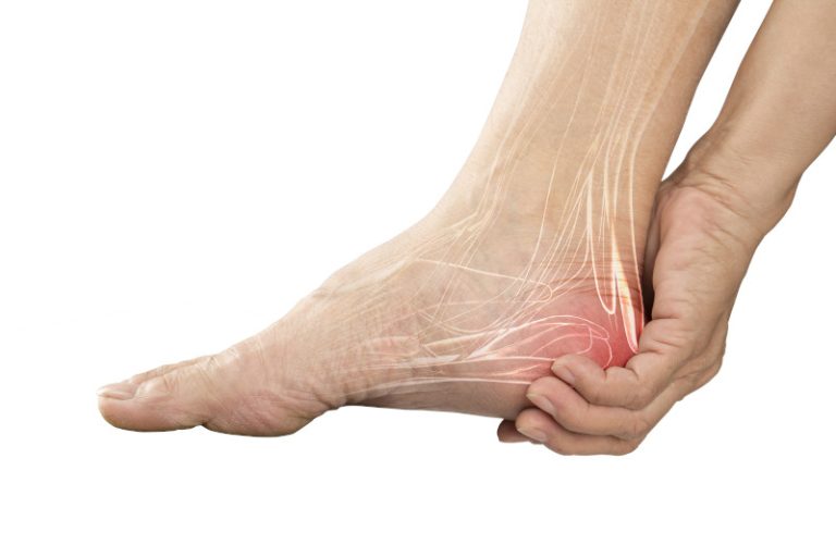 10 Warning Sign Poor Blood Poor Circulation in Legs Pictures with ...